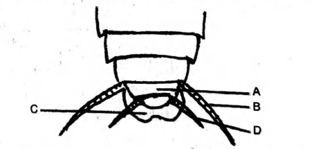 The diagram represents the reproductive organs of male cockroach ...